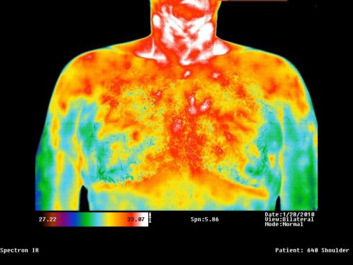 Medical Infrared Imaging | Infrared Distributions Ltd